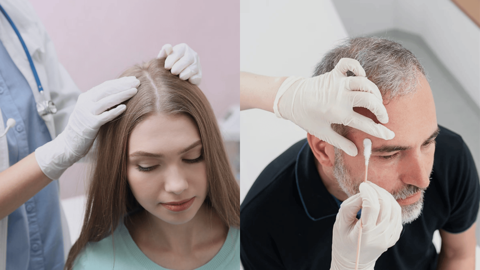 Pilar Cyst vs Sebaceous Cyst: Key Differences - Obviousmag