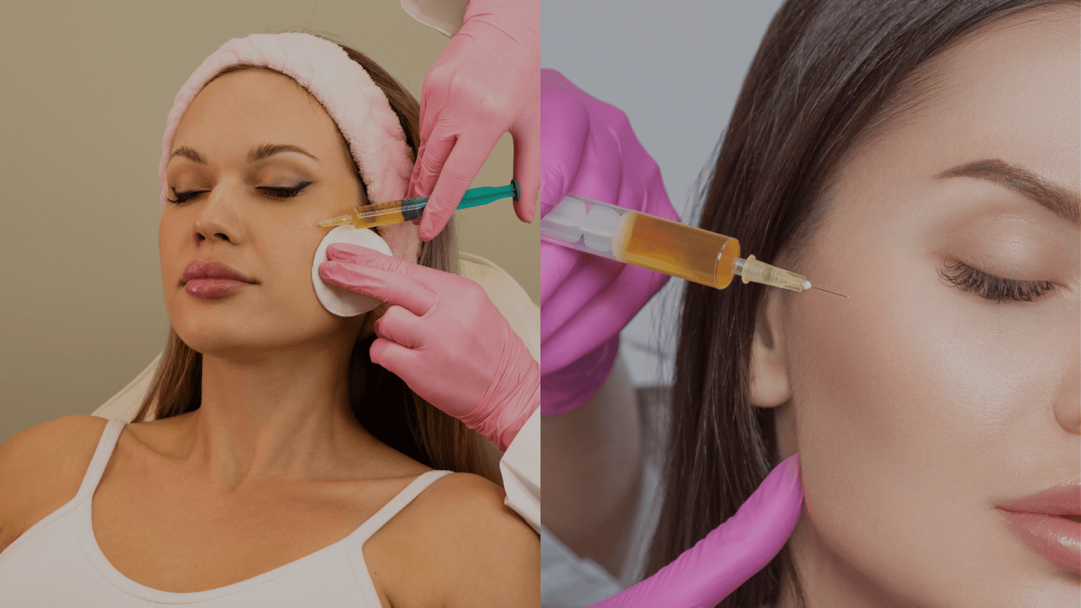 All About PRP for Under Eyes - Obviousmag